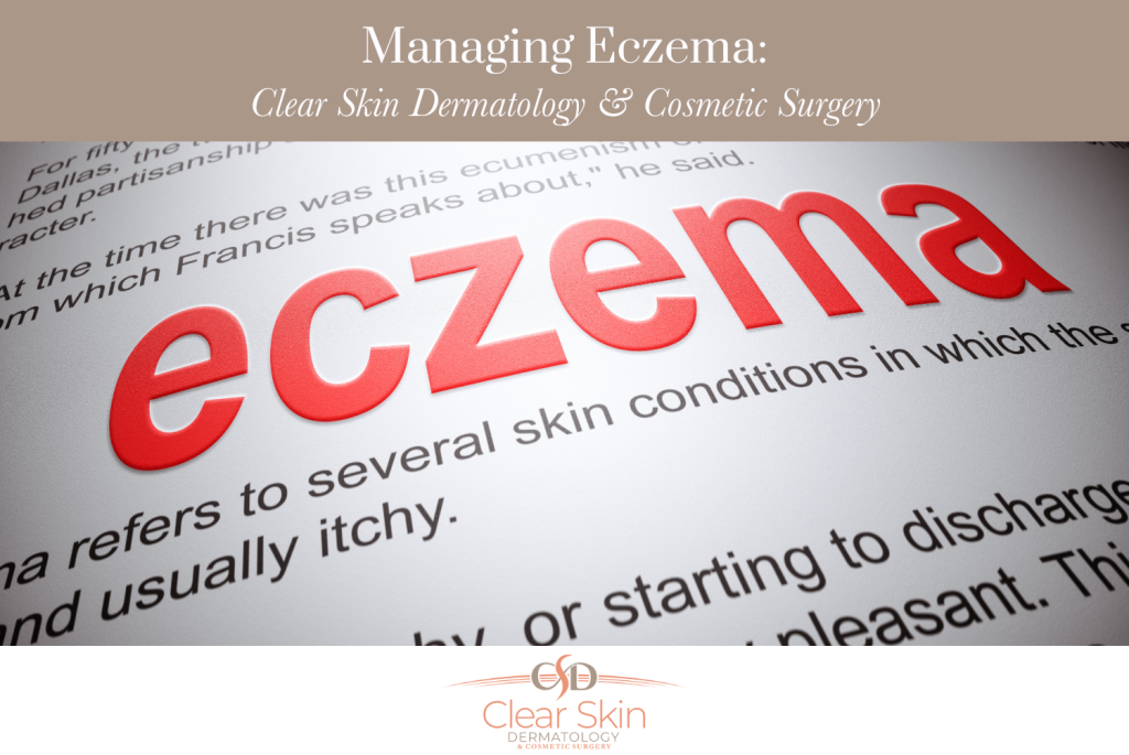 Managing Eczema: Clear Skin Dermatology & Cosmetic Surgery | Clear Skin ...